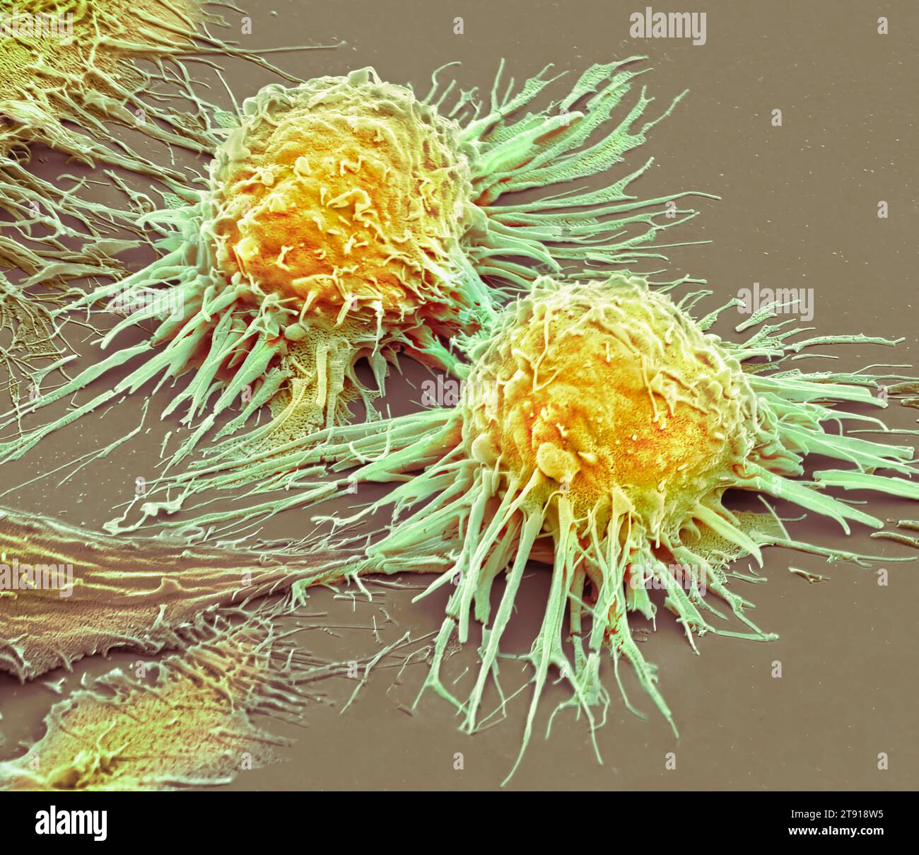 Dividing HeLa cells, SEM Stock Photo - Alamy