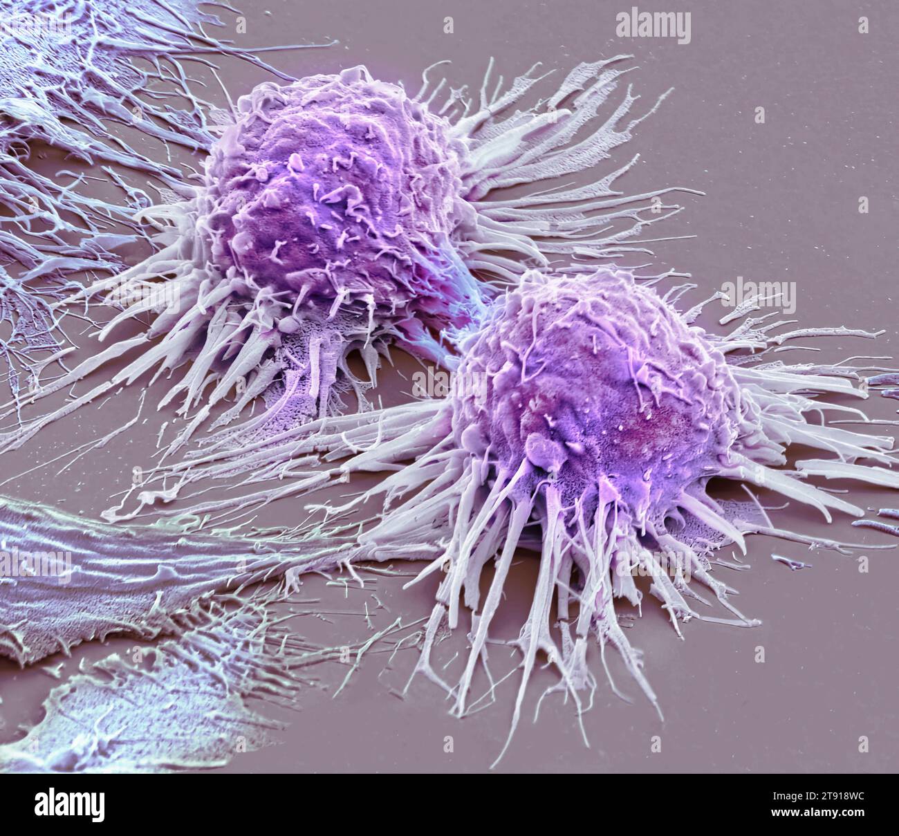 Dividing HeLa cells, SEM Stock Photo - Alamy