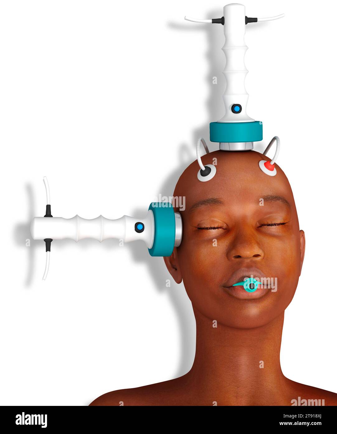 Electroconvulsive therapy, illustration Stock Photo - Alamy