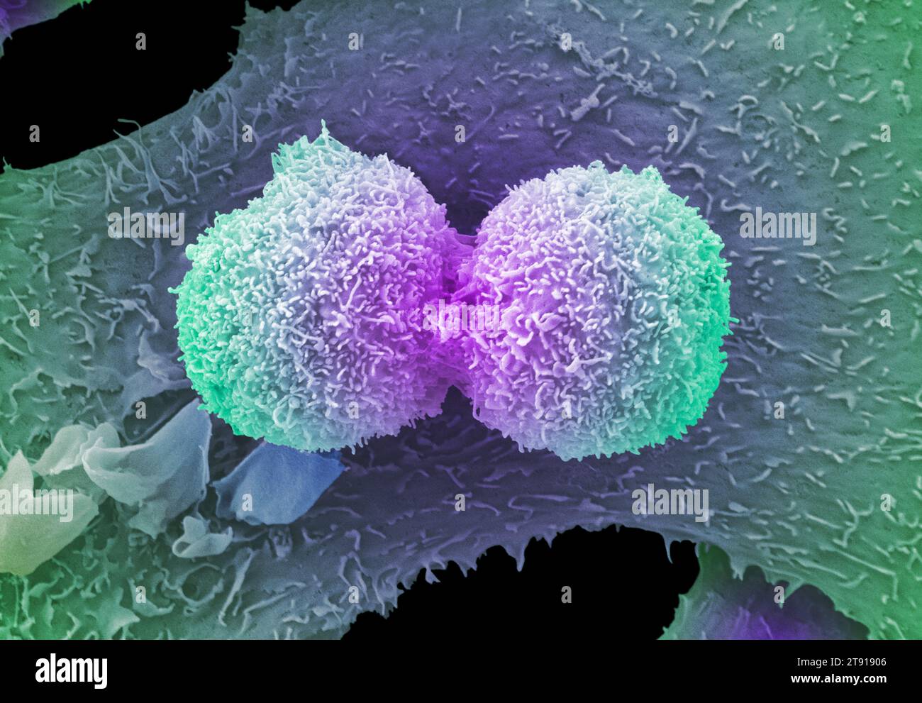 Lung cancer cells dividing, SEM Stock Photo - Alamy