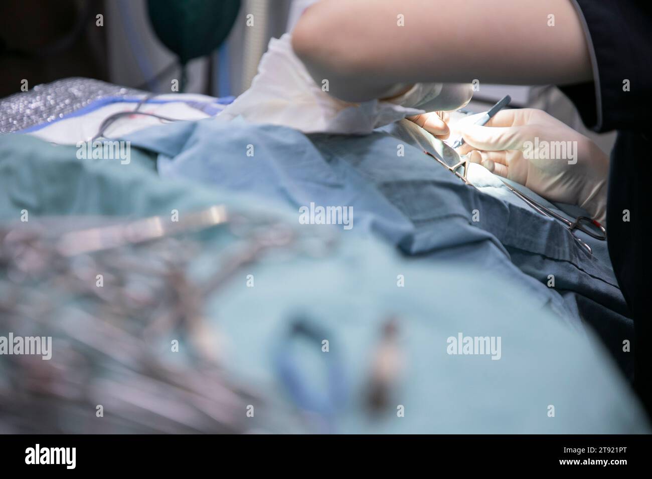 Hand surgery hi-res stock photography and images - Alamy