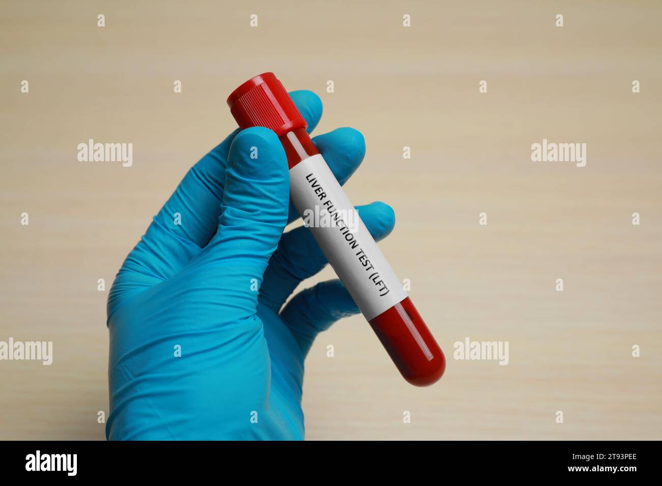 Laboratory worker holding tube with blood sample and label Liver ...