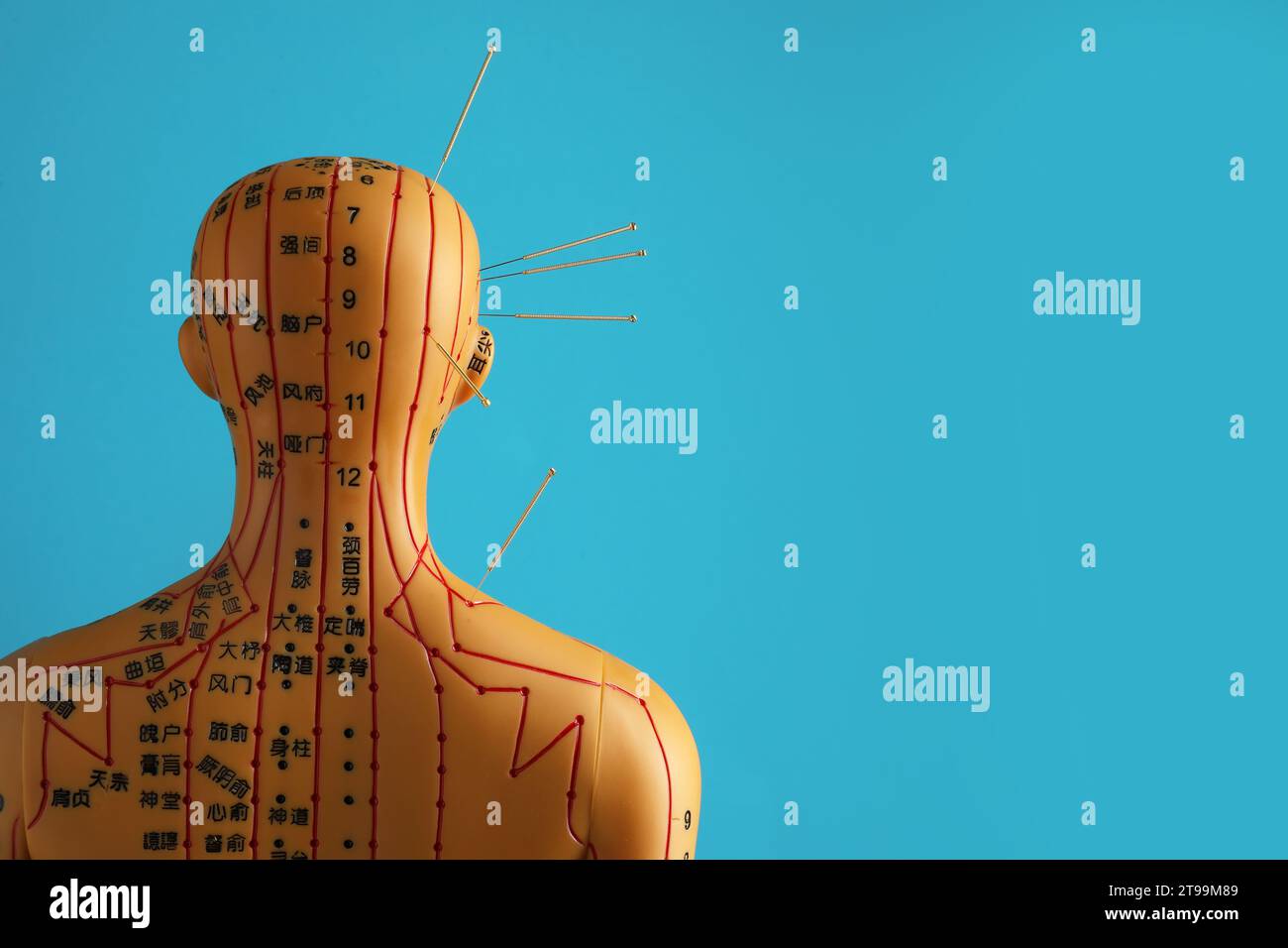 Acupuncture - alternative medicine. Human model with needles in head ...