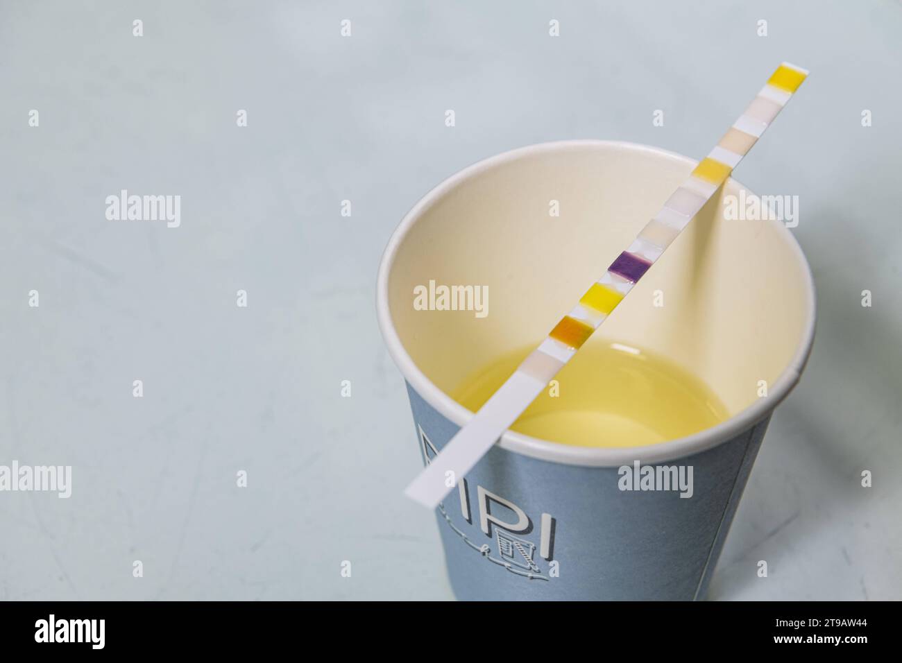 Urintest mit Indikatorstreifen Urinuntersuchung *** Urine test with ...