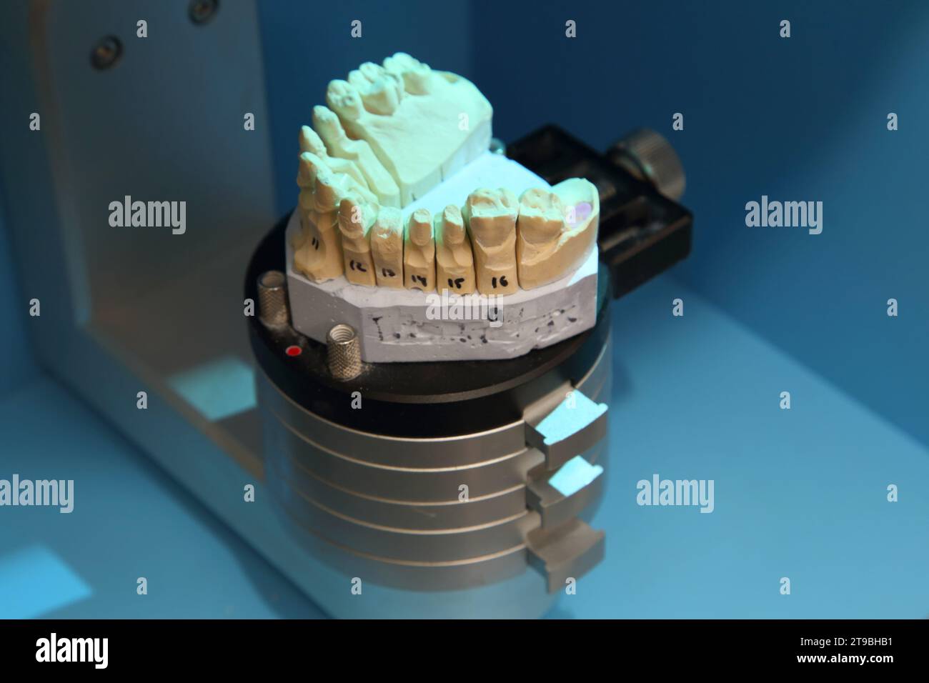 Fabrication of dental crowns and dentures made of ceramic. Scanning of ...