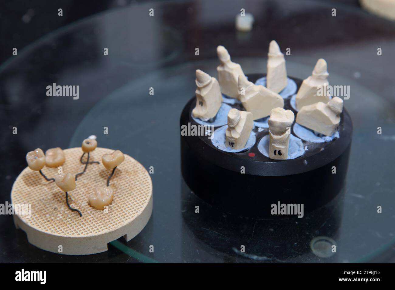 Fabrication of dental crowns and dentures made of ceramic. Scanning of ...