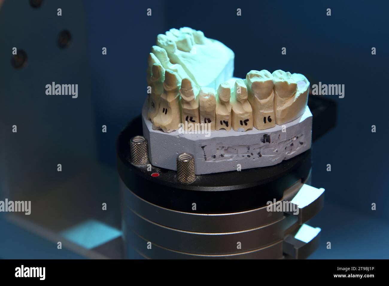 Fabrication of dental crowns and dentures made of ceramic. Scanning of ...