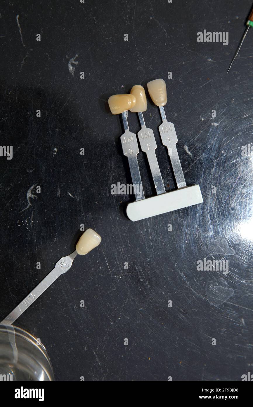 Fabrication of dental crowns and dentures made of ceramic. Scanning of ...