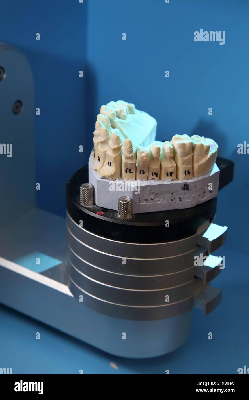 Fabrication of dental crowns and dentures made of ceramic. Scanning of ...