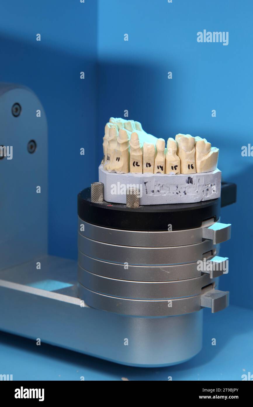 Fabrication of dental crowns and dentures made of ceramic. Scanning of ...