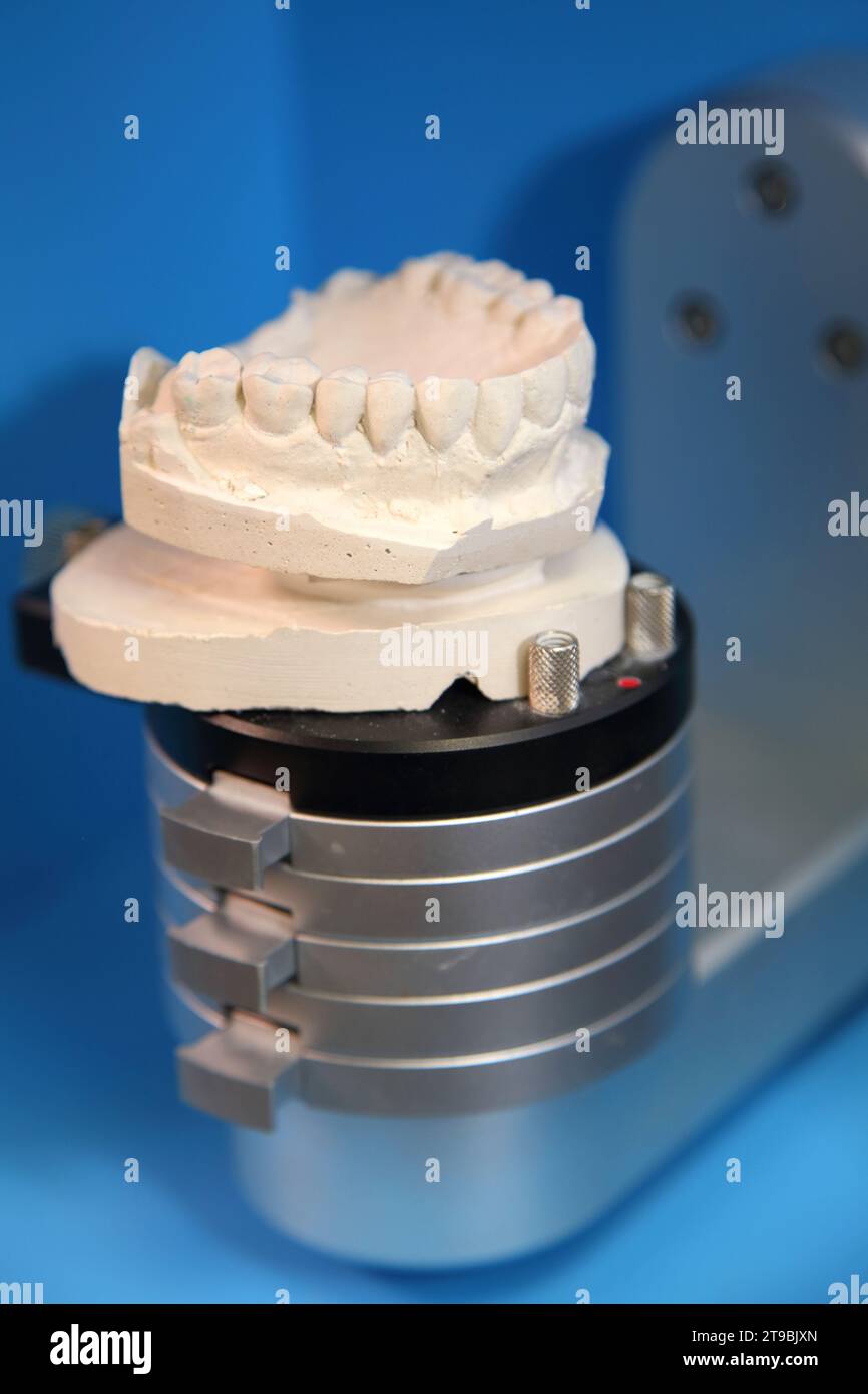 Fabrication of dental crowns and dentures made of ceramic. Scanning of ...