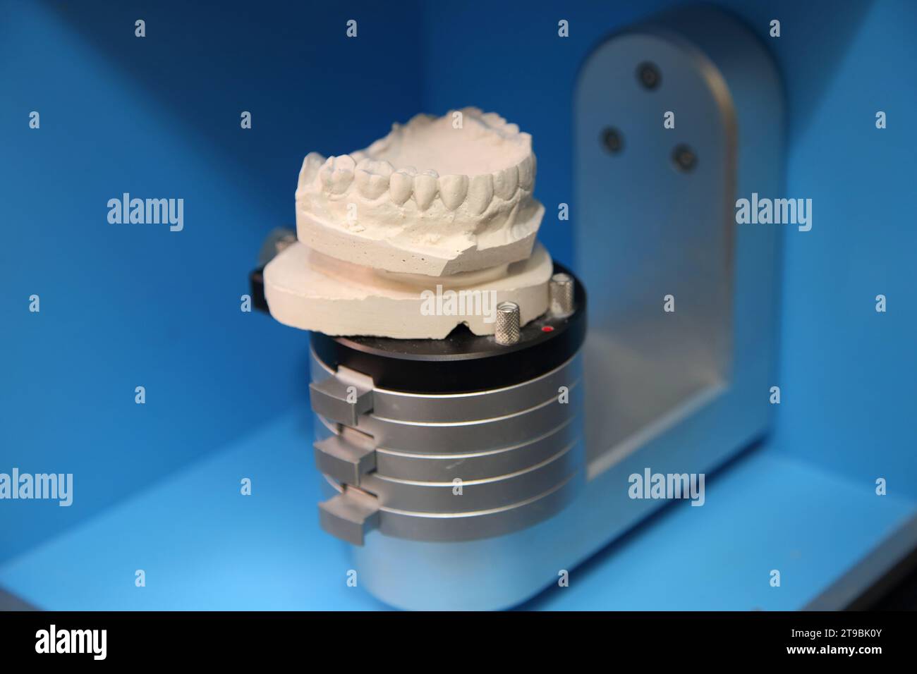 Fabrication of dental crowns and dentures made of ceramic. Scanning of ...