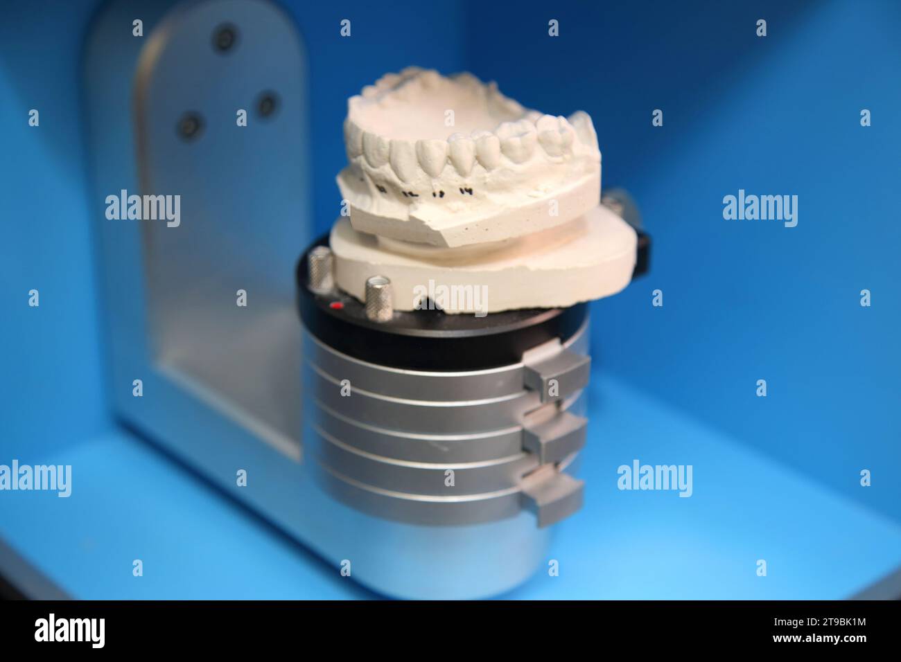 Fabrication of dental crowns and dentures made of ceramic. Scanning of ...