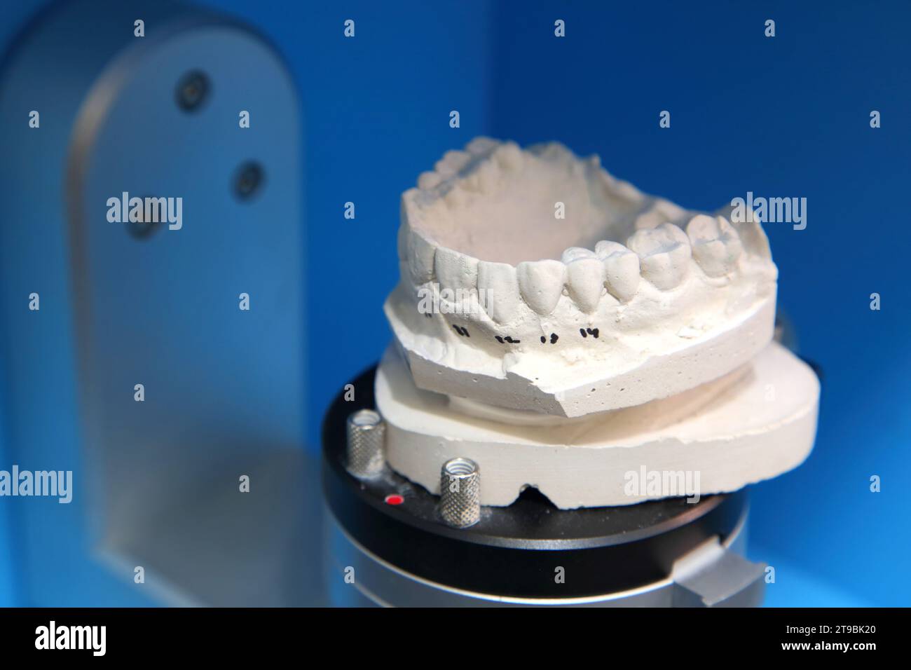 Fabrication of dental crowns and dentures made of ceramic. Scanning of ...