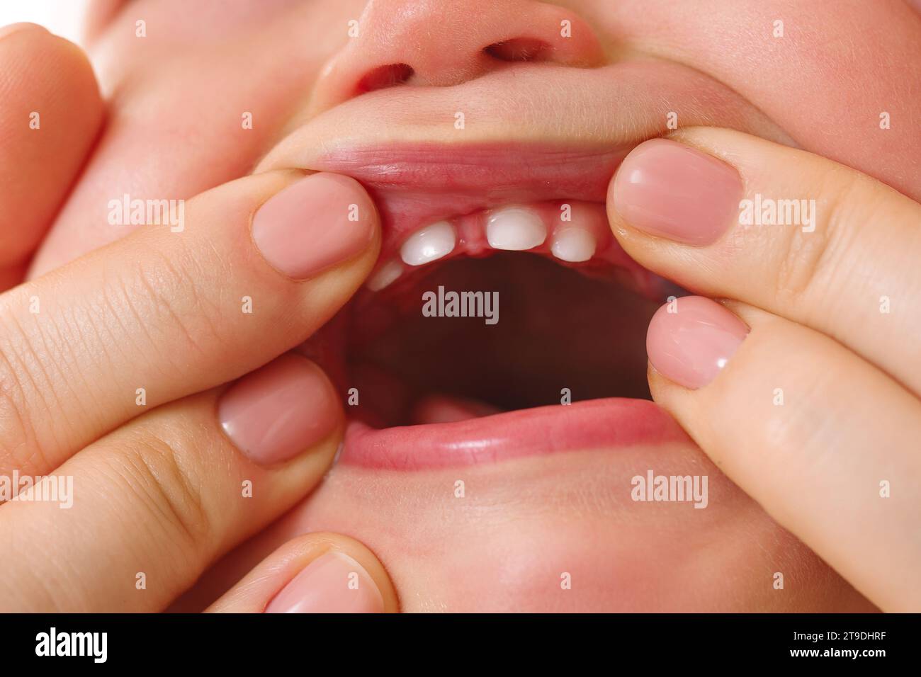 Closeup shot of a mother opening her little child's mouth with freshly ...