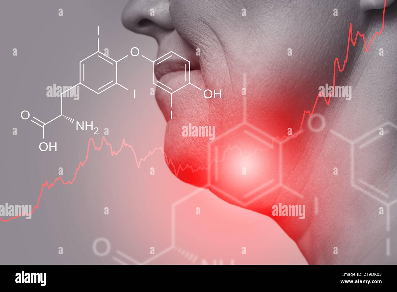 Female neck and triiodothyronine hormone formula produced by thyroid ...