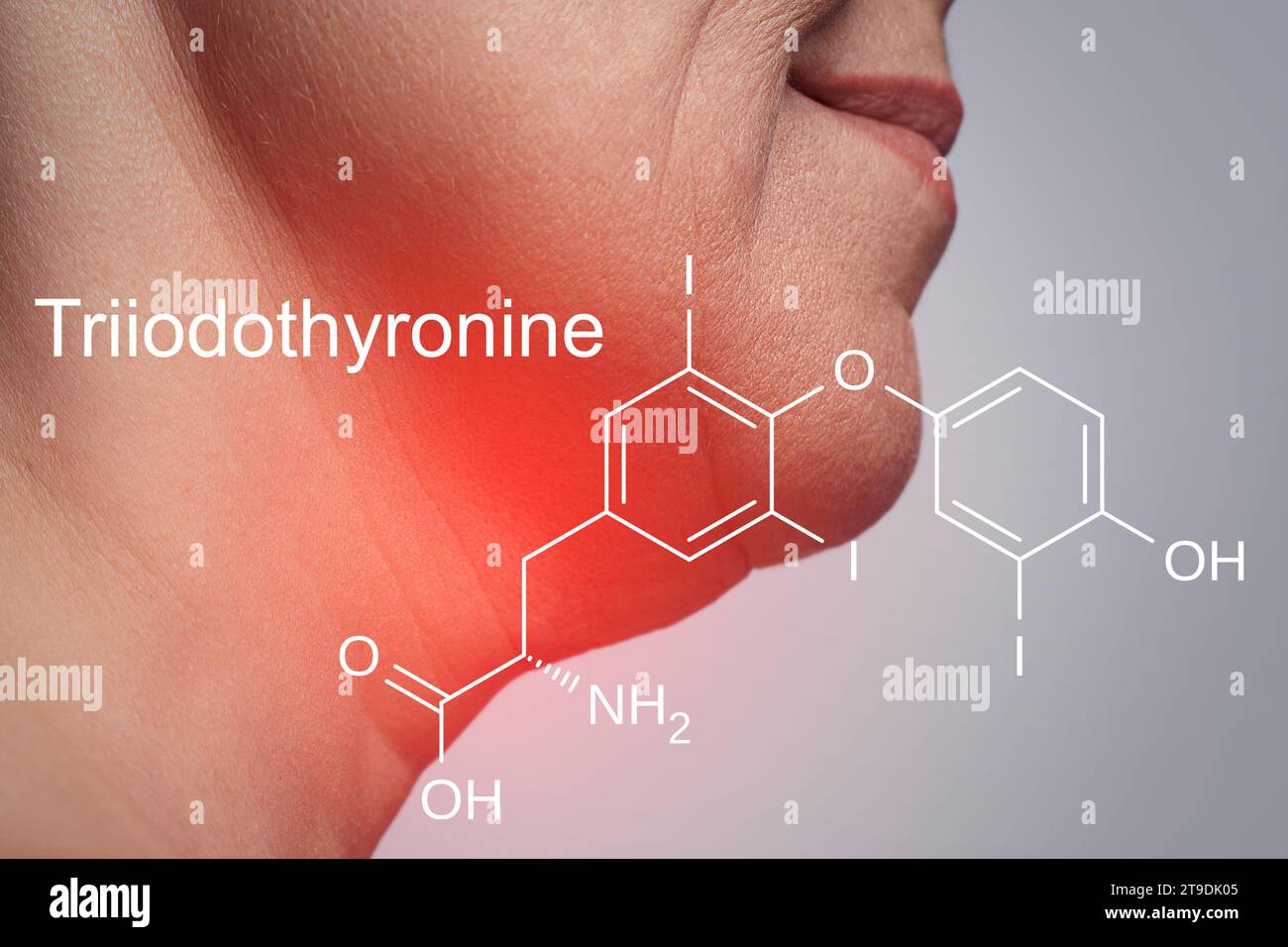 Female neck and triiodothyronine hormone formula produced by thyroid ...