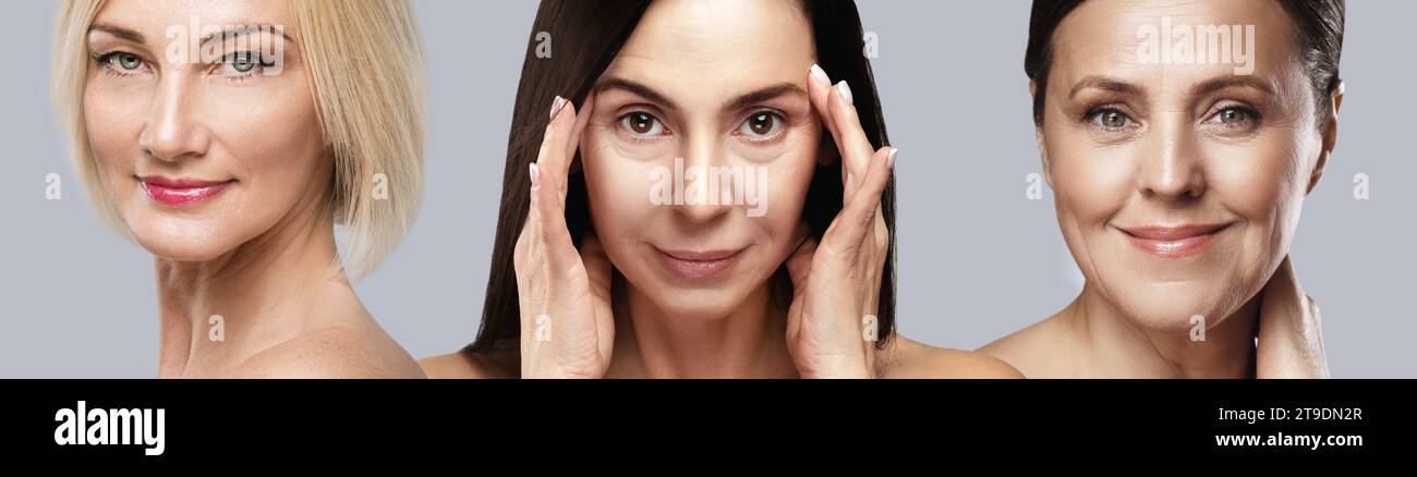 Group of different good looking middle aged women with wrinkled skin ...
