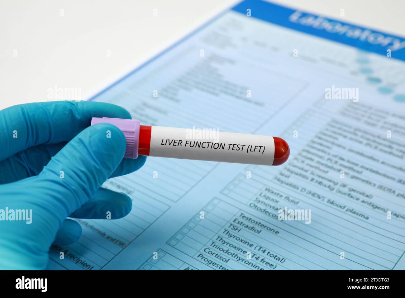 Laboratory worker holding tube with blood sample and label Liver ...