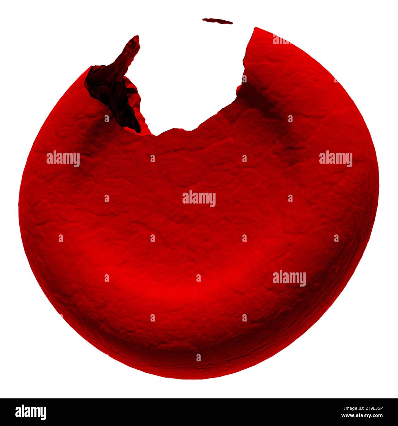 Illustration of an abnormal red blood cell (erythrocyte) known as a ...