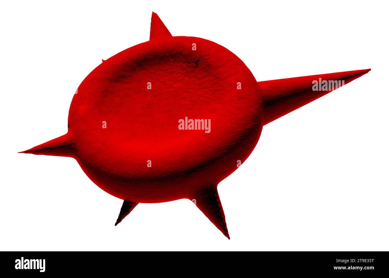Spur cell abnormal red blood cell, illustration Stock Photo - Alamy