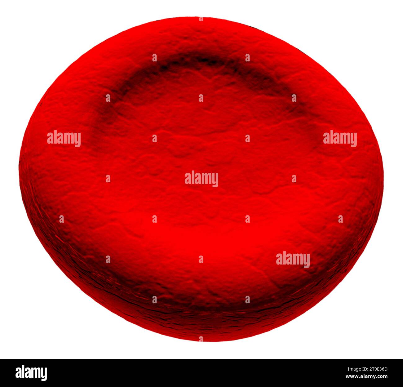 Thalassemia red cell hi-res stock photography and images - Alamy