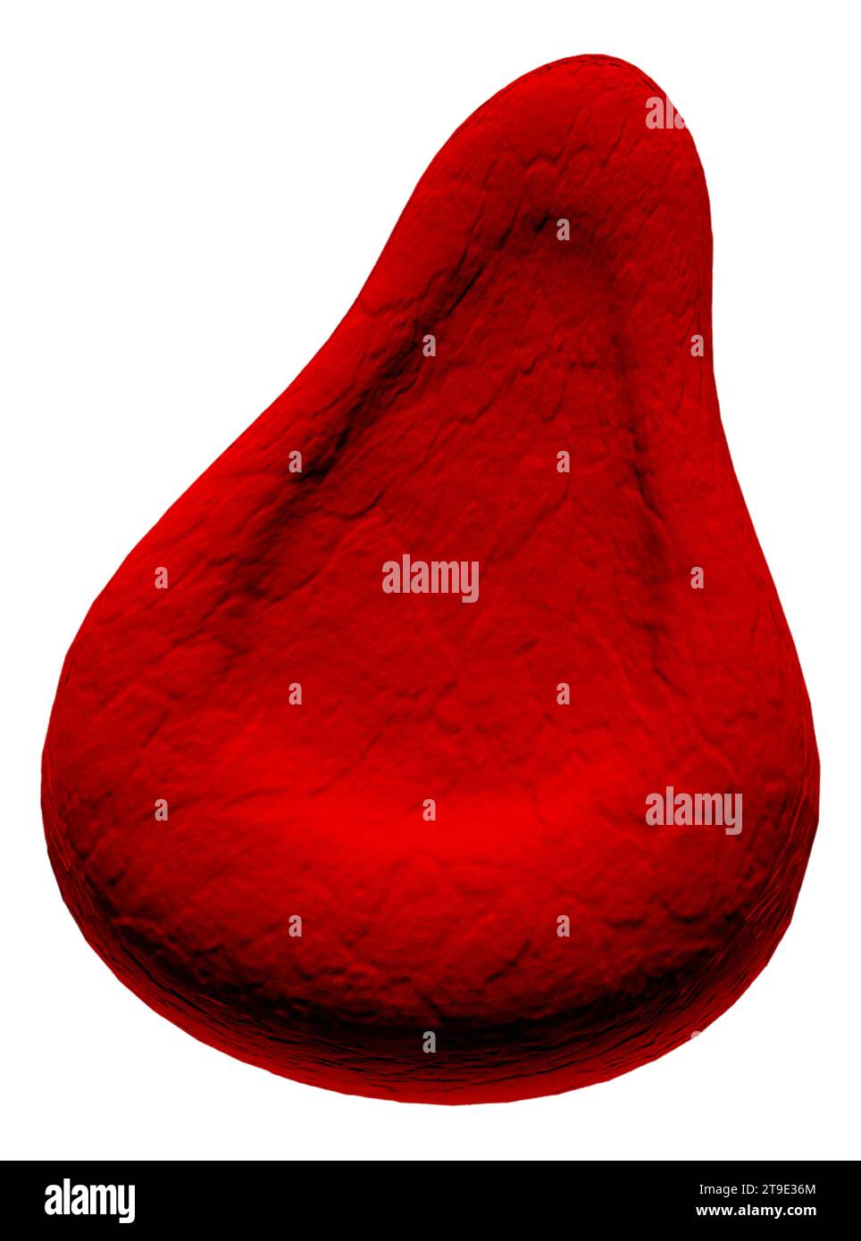 Teardrop cell abnormal red blood cell, illustration Stock Photo - Alamy Teardrop cell abnormal red blood cell, illustration Stock Photo - Alamy