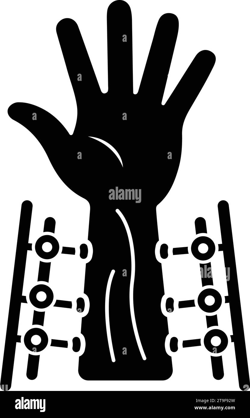 Inflammation of the joints Black and White Stock Photos & Images - Alamy