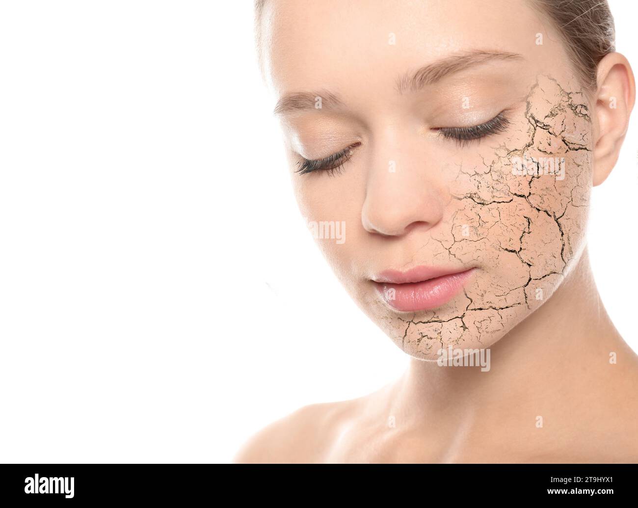 Beautiful young woman with dry skin on white background, closeup Stock ...
