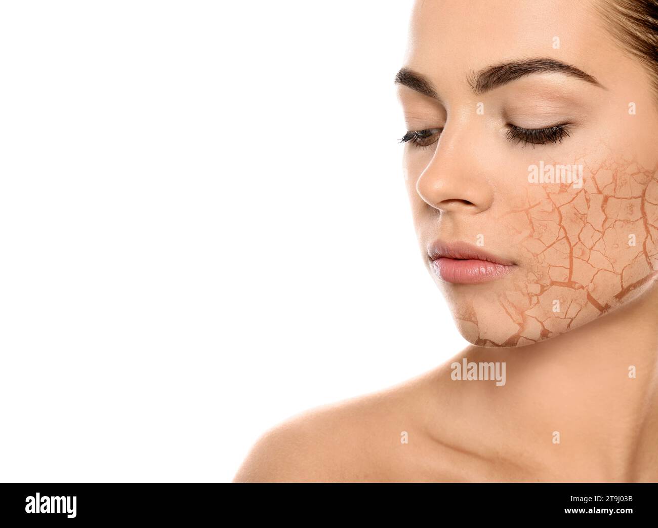 Beautiful young woman with dry skin on white background, closeup Stock ...
