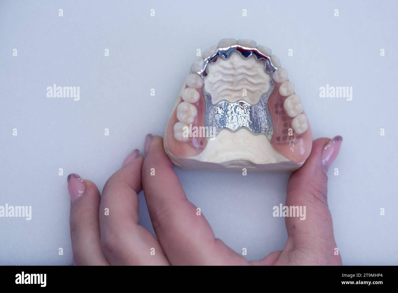 Dental teeth dentists model. Models of human jaws in an orthodontic ...