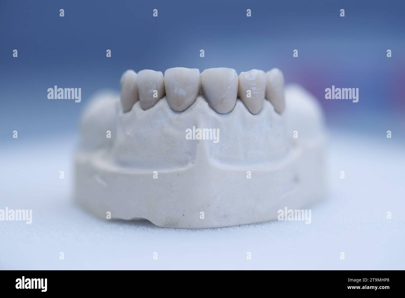 Dental teeth dentists model. Models of human jaws in an orthodontic ...