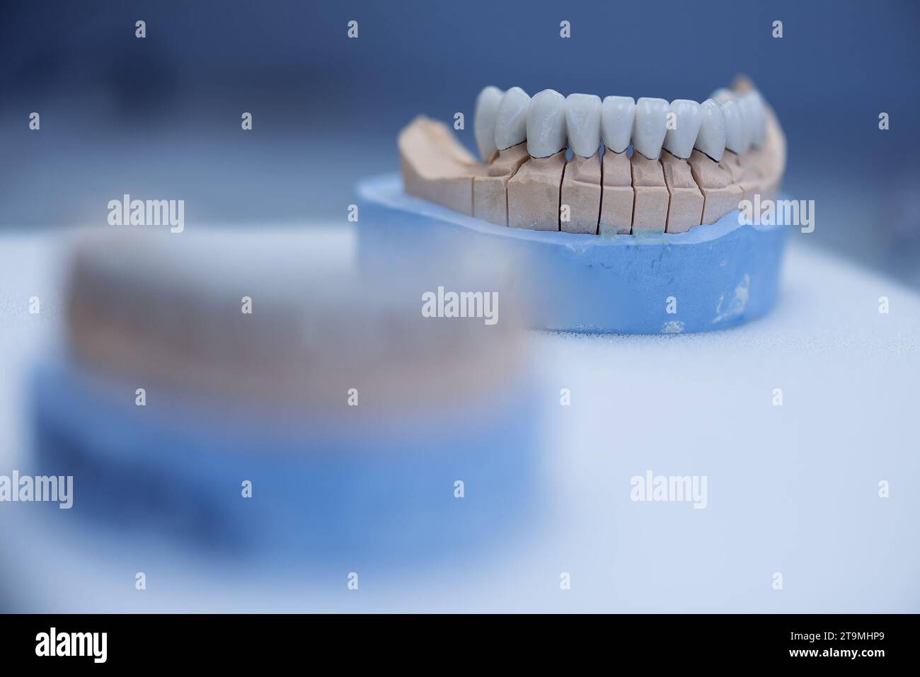 Dental teeth dentists model. Models of human jaws in an orthodontic ...