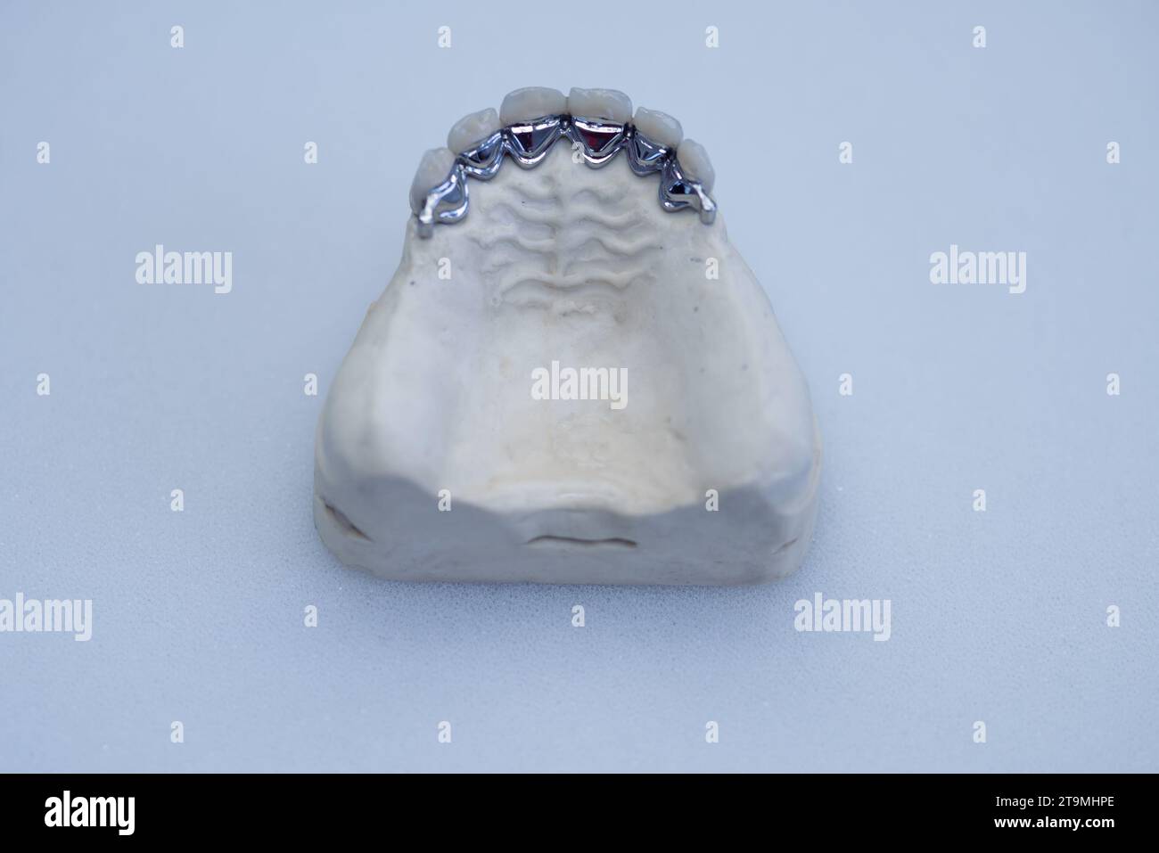 Dental teeth dentists model. Models of human jaws in an orthodontic ...