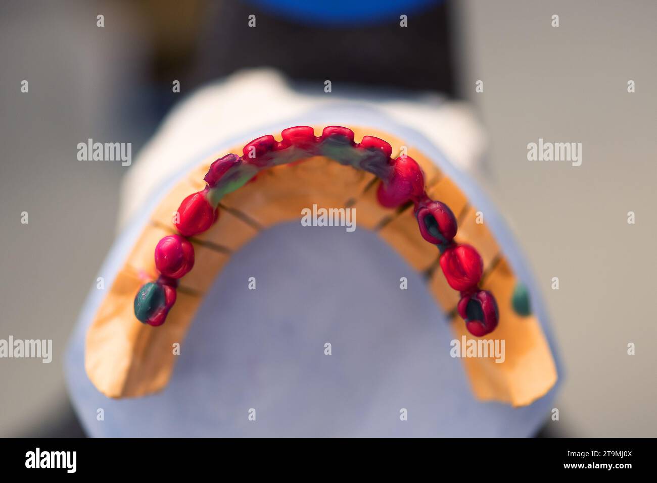 Dental teeth dentists model. Models of human jaws in an orthodontic ...