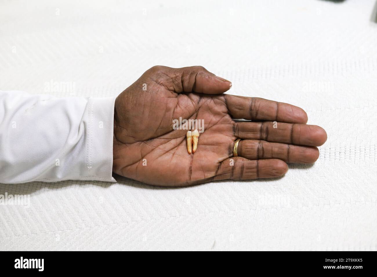 A black African-American man holding a loose tooth in his hand Stock ...