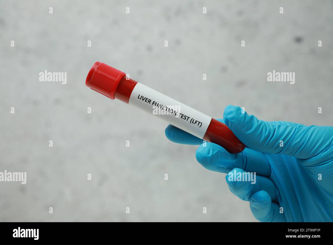 Laboratory worker holding tube with blood sample and label Liver ...