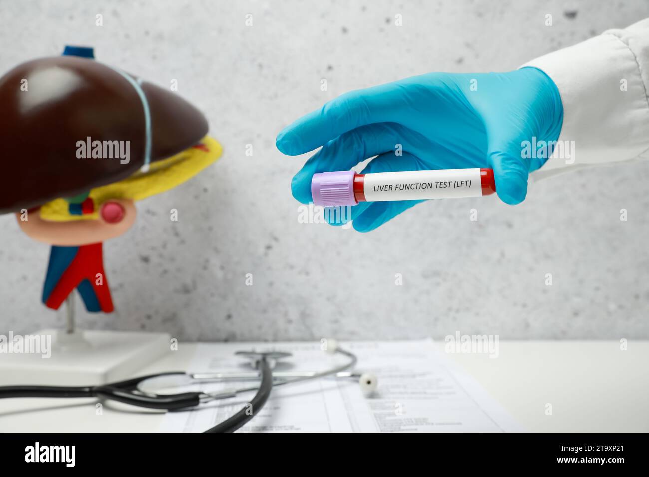 Laboratory worker holding tube with blood sample and label Liver ...