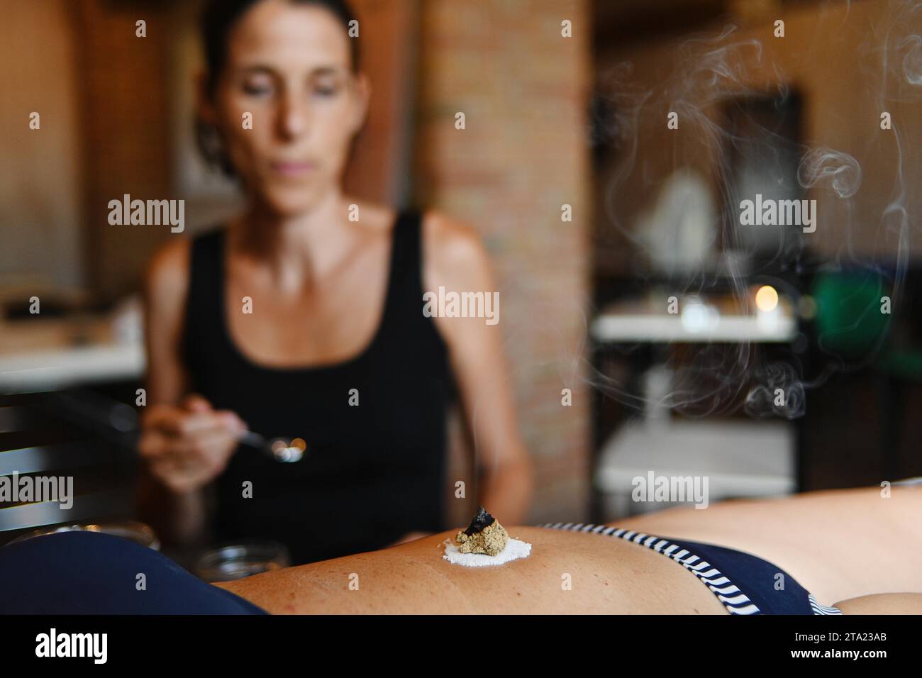 Therapist apply abdominal moxibustion chinese medicine burn mugwort ...