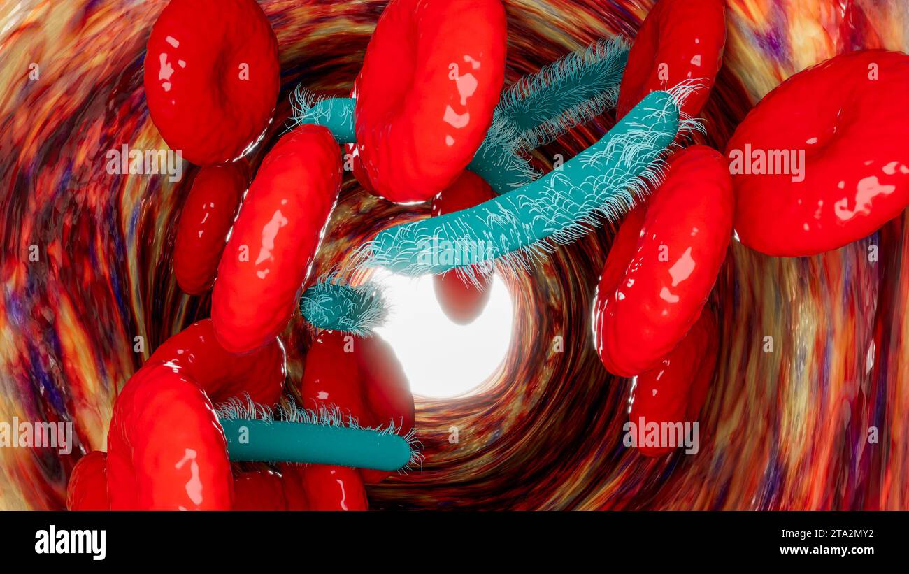 Blood flow, vein and red blood cells and sepsis. It is a potentially ...