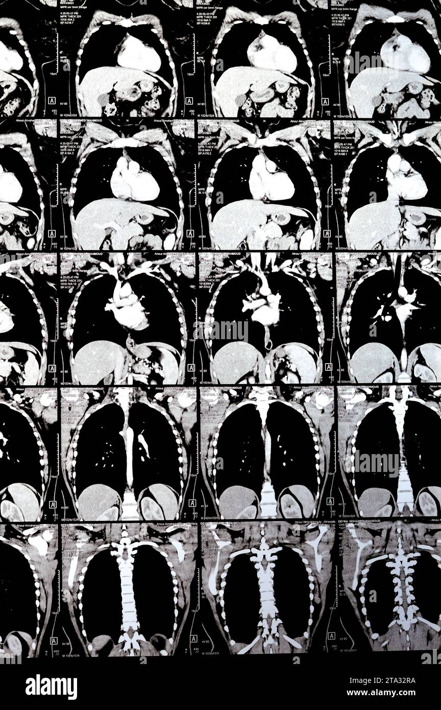 Radiological contrast hi-res stock photography and images - Alamy