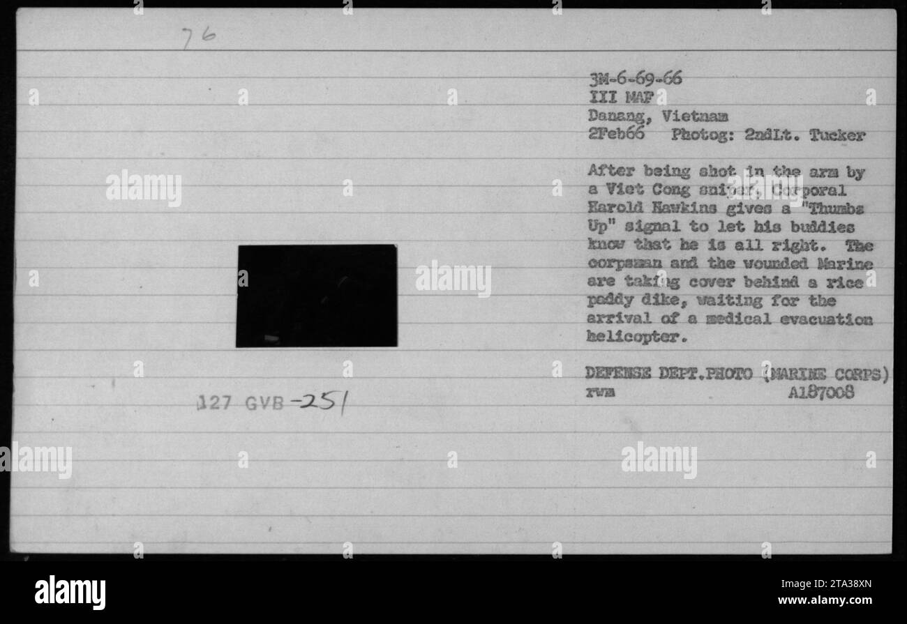 Corporal Harold Hawkins signals 'Thumbs Up' after being shot by a Viet ...