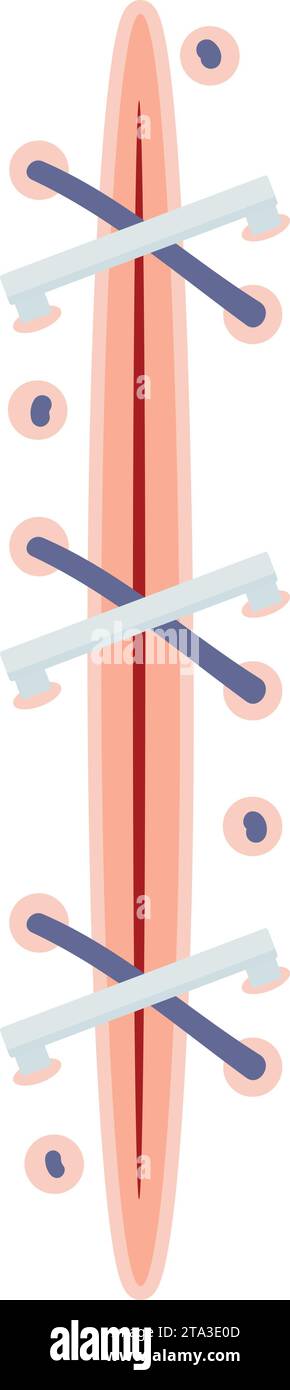 Suture wound icon cartoon vector. Doctor incision Stock Vector Image & Art - Alamy