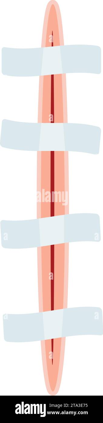 Doctor incision Cut Out Stock Images & Pictures - Alamy