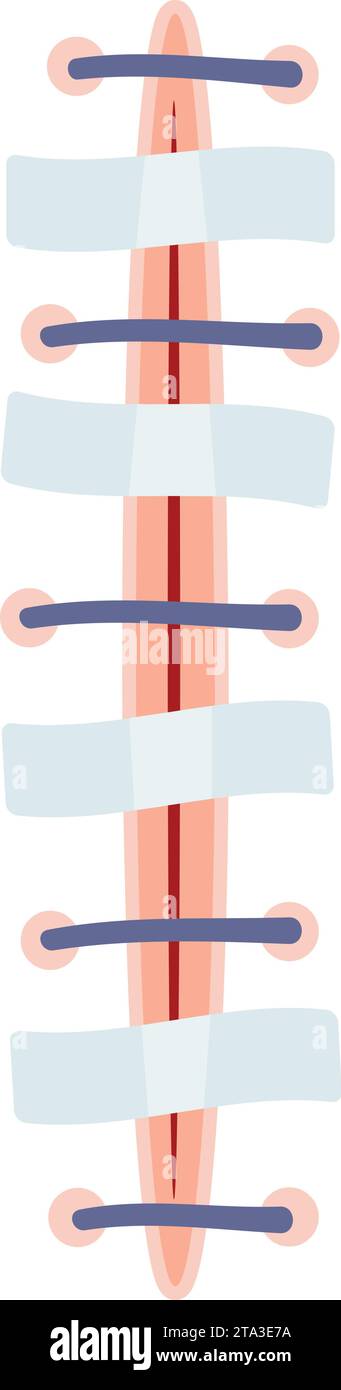Suture icon cartoon vector. Surgical suture Stock Vector Image & Art - Alamy