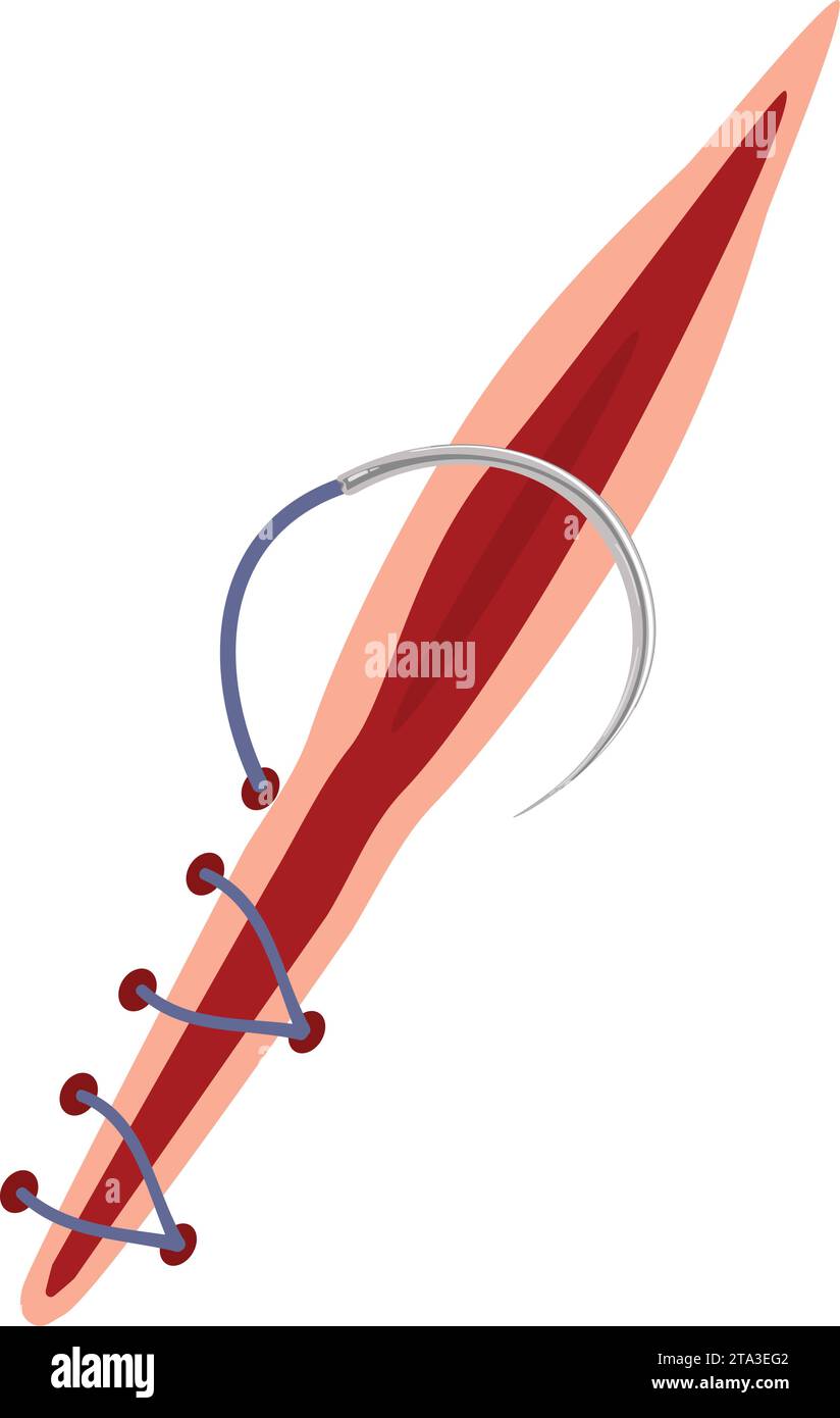 Health gross suture icon cartoon vector. Medical surgeon care Stock ...