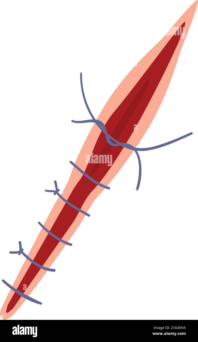 Half open suture icon cartoon vector. Medical skin cut Stock Vector Image & Art - Alamy