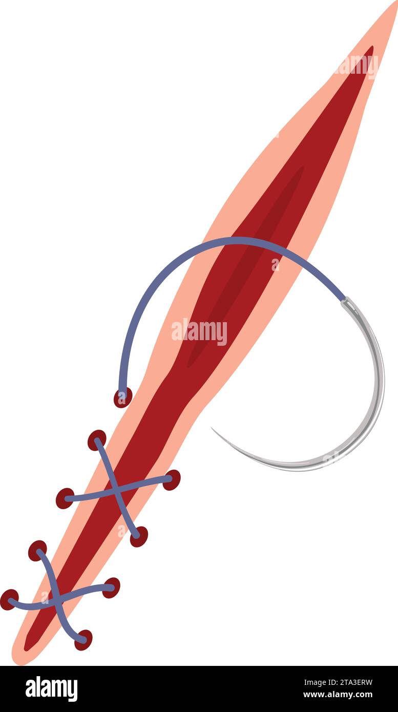 Scar suture icon cartoon vector. Skin injury cut Stock Vector Image & Art - Alamy