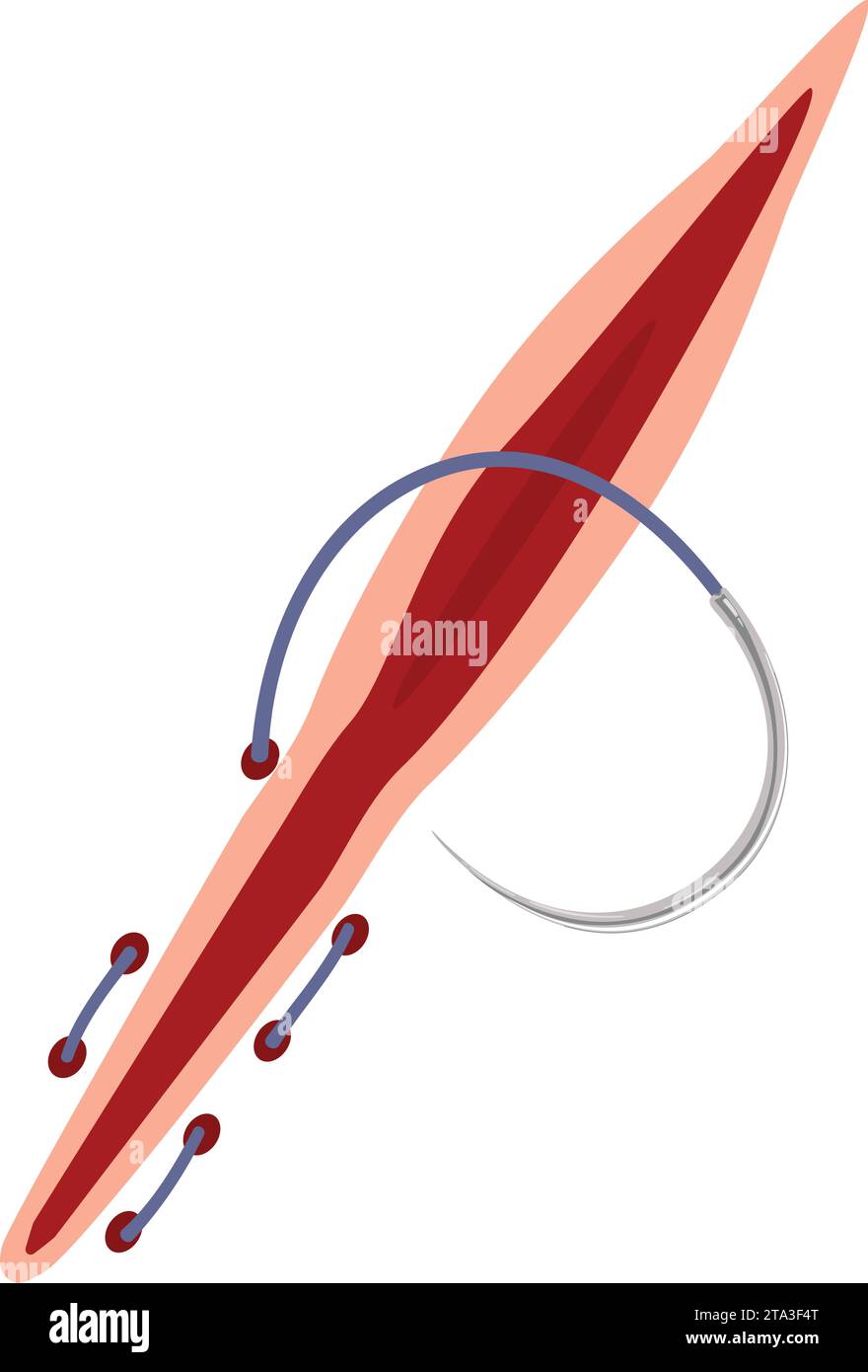Medic suture cut icon cartoon vector. Skin injury Stock Vector Image ...