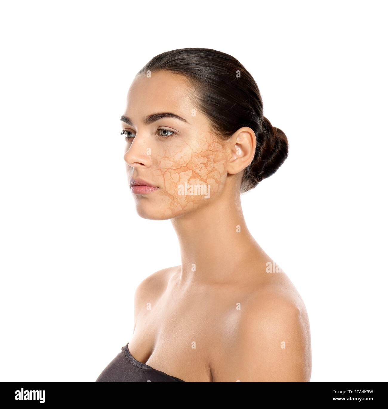 Beautiful young woman with dry skin on white background Stock Photo - Alamy